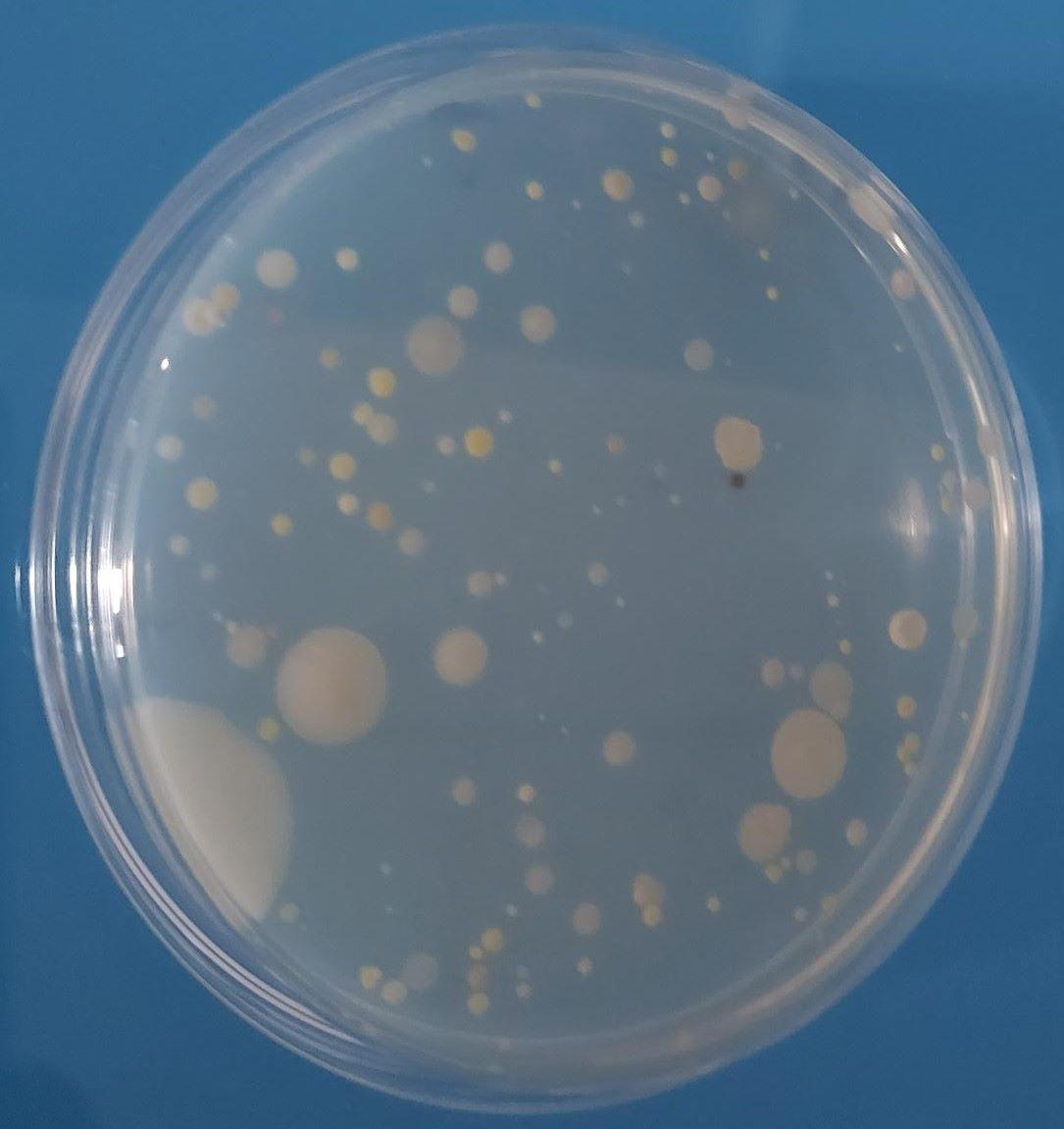 Adaptation microbienne - Laboratoire d'optique et biosciences