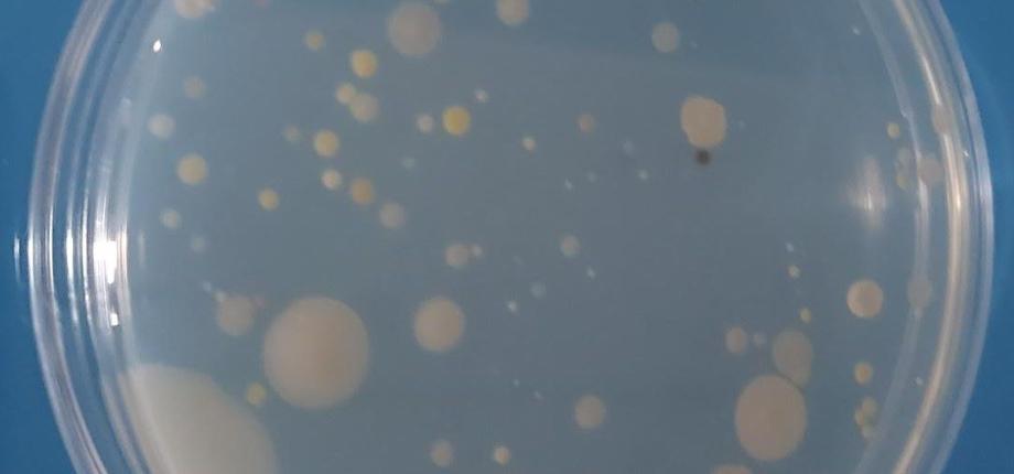 Microbial adaptation | Laboratoire d'optique et biosciences